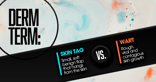 What to Do About Warts - Alamo Heights Dermatology