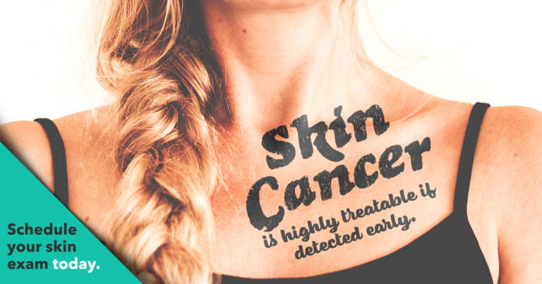 Understanding Skin Cancer and the Importance of Early Detection - Alamo ...