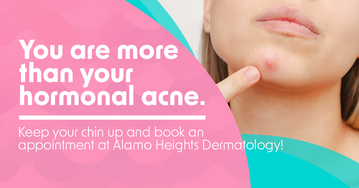 The Breakout Battle: Understanding Hormonal Acne - Alamo Heights ...