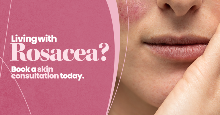 Rosacea Awareness Month - Alamo Heights Dermatology